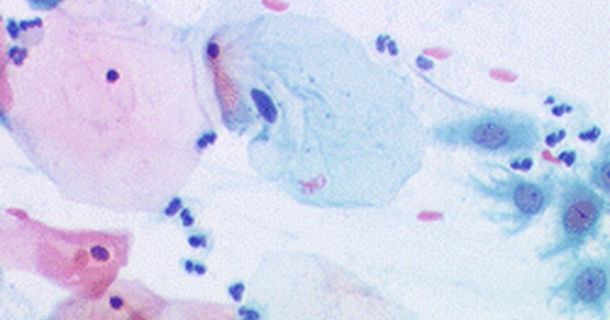 BSCCP | Cytology images